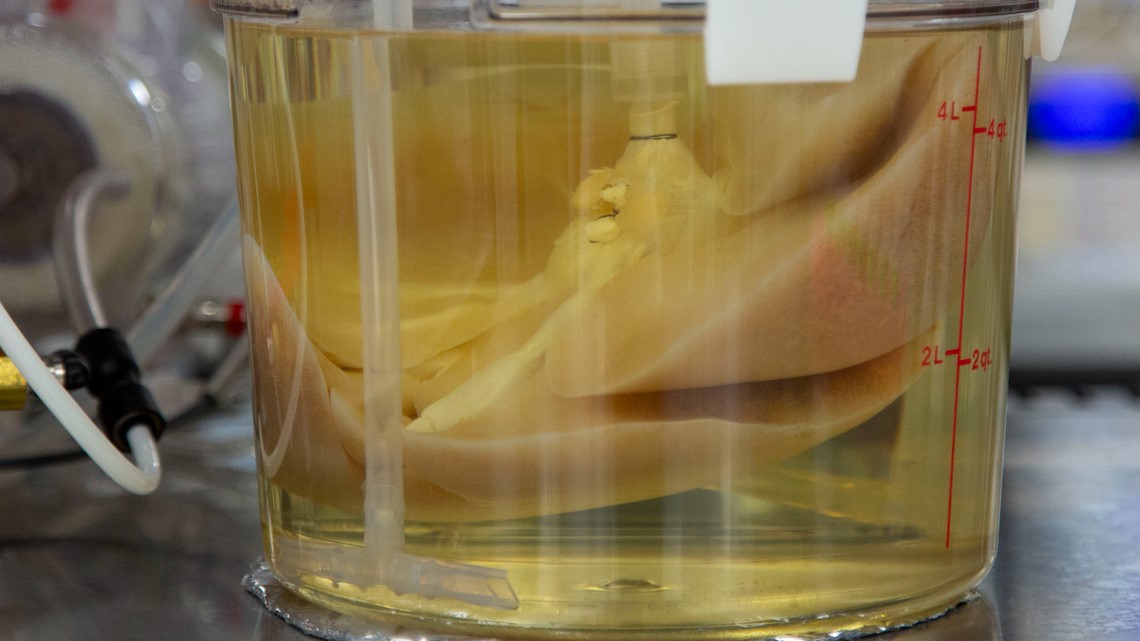 Pig livers could be the next transplant breakthrough | wbir.com