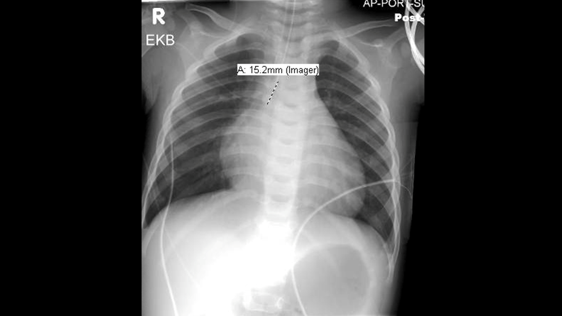 Colorado doctors claim first marijuana overdose death | wbir.com