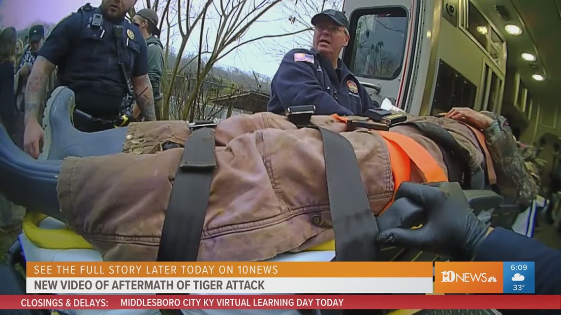 New video shows aftermath of tiger attack that nearly took 18 year-old's arm off | wbir.com