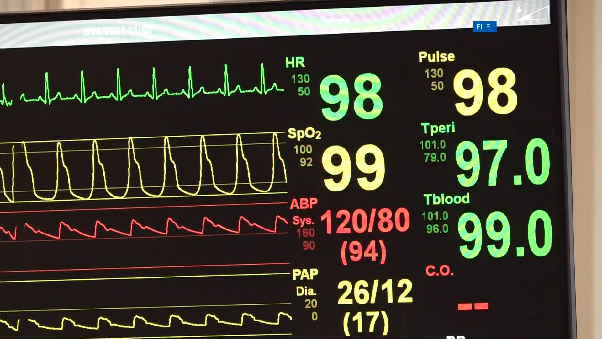 Thousands to lose insurance as Tennessee shuts down programs | wbir.com