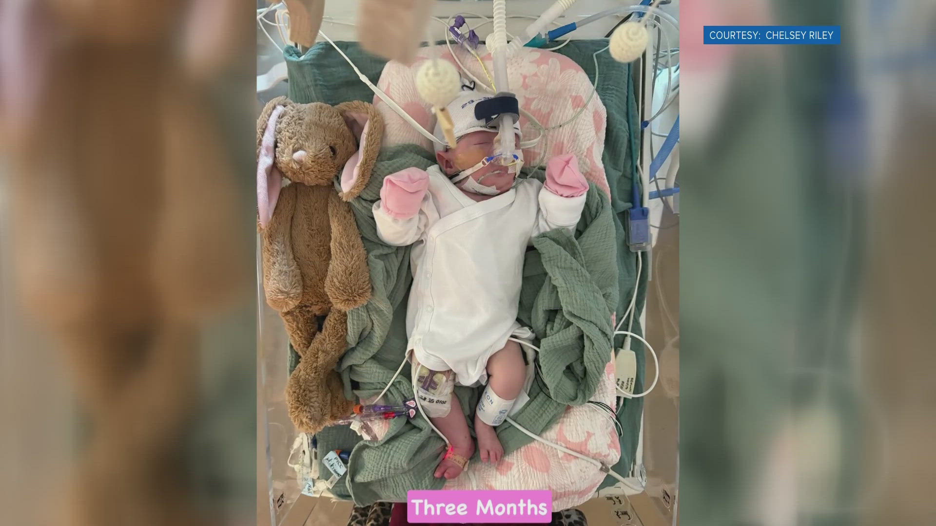 Knoxville baby born with Trisomy 18 defies odds | wbir.com