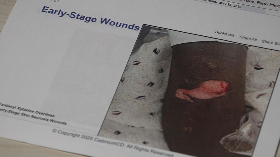 Toxic Trends: Tracking Tranq | Former user shares her story, aftermath ...