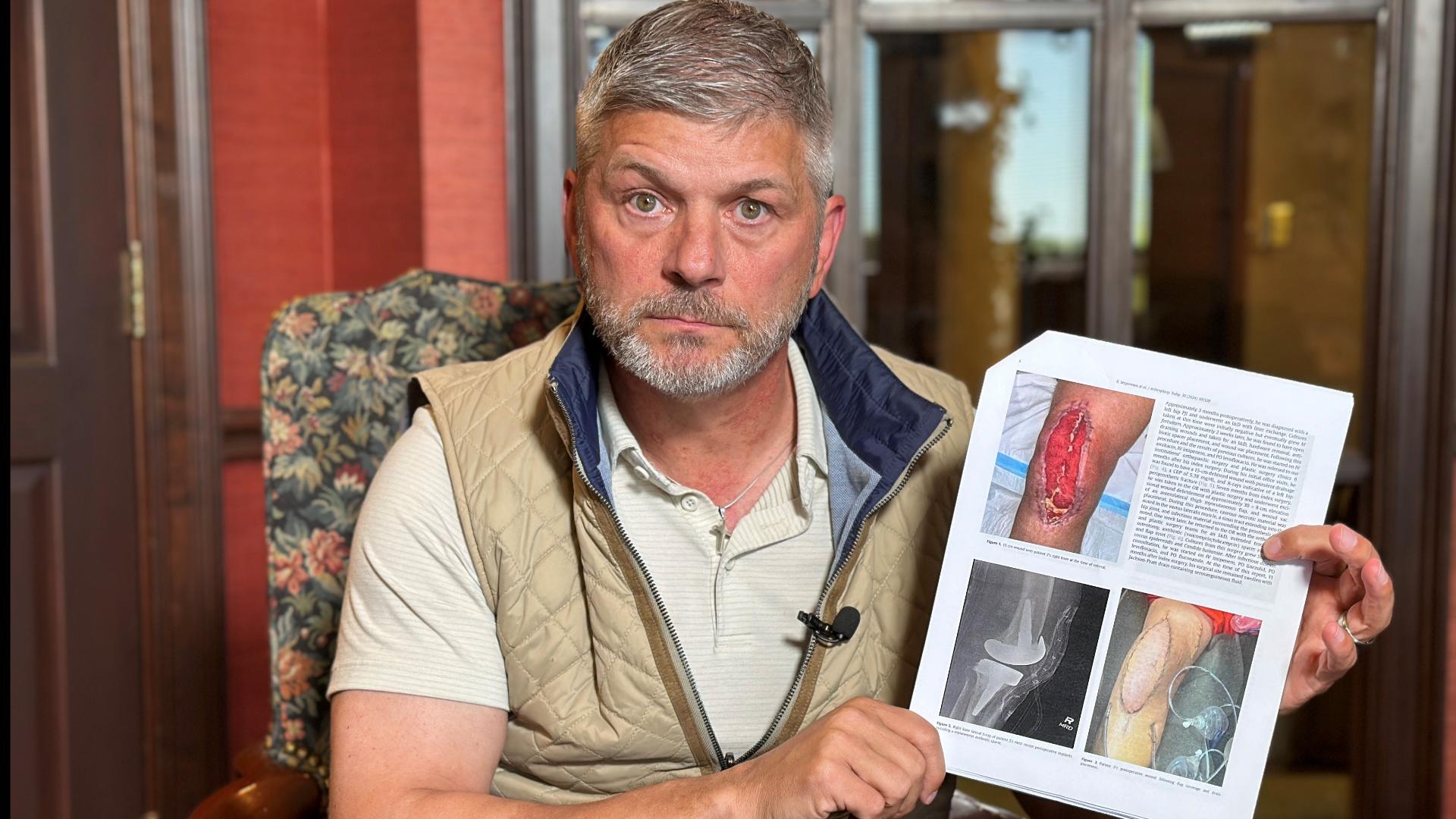 Parkwest Surgery Center faces lawsuits over infections | wbir.com